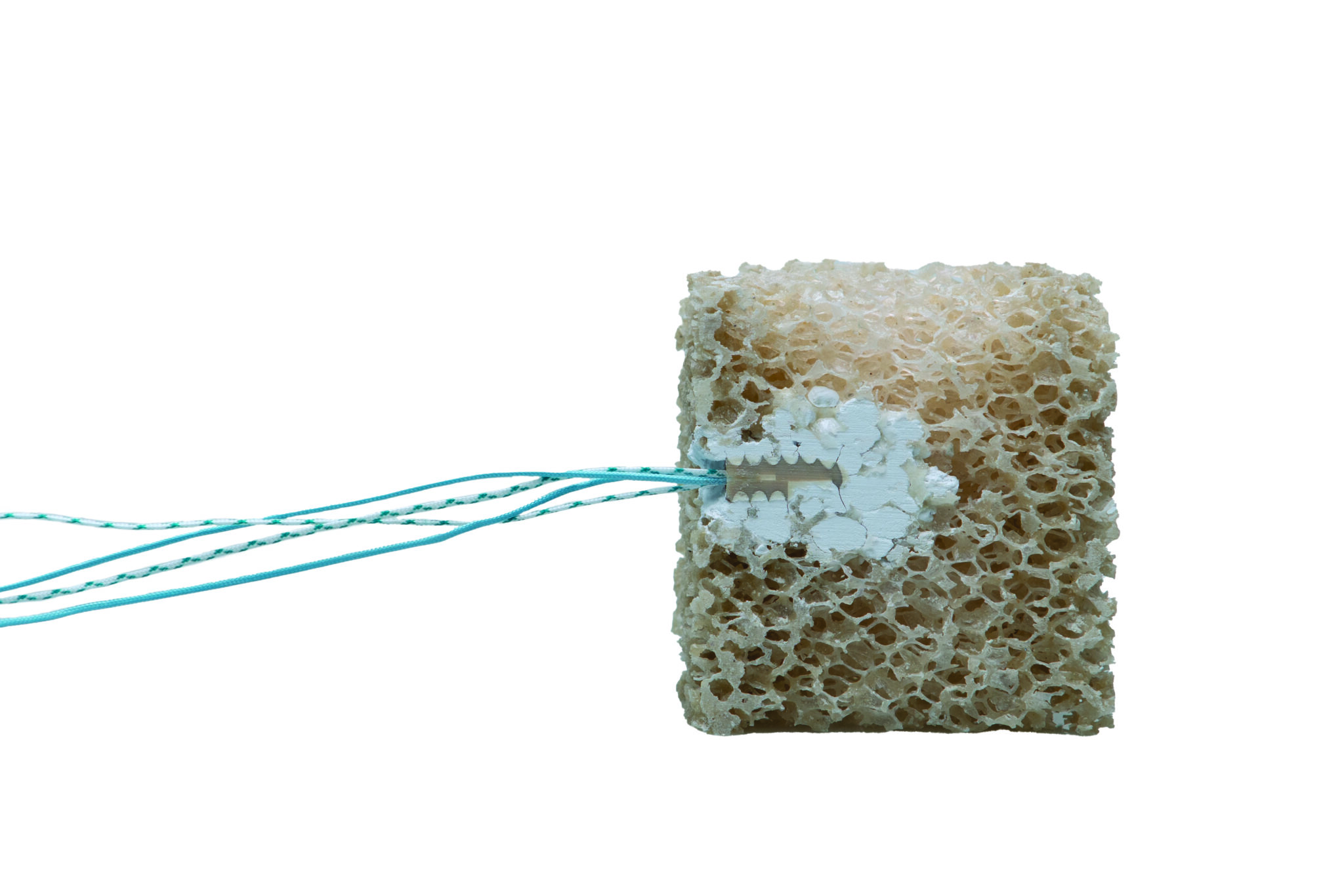 Tactoset Injectable Bone Substitute | Anika